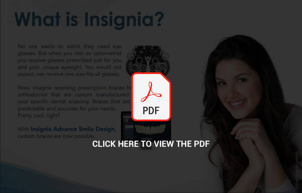 Insignia – Fully Customized Labial Orthodontics | Best Treatment for ...